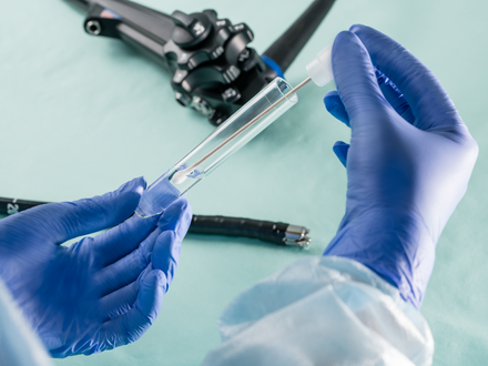 Quality Assurance in Endoscopy